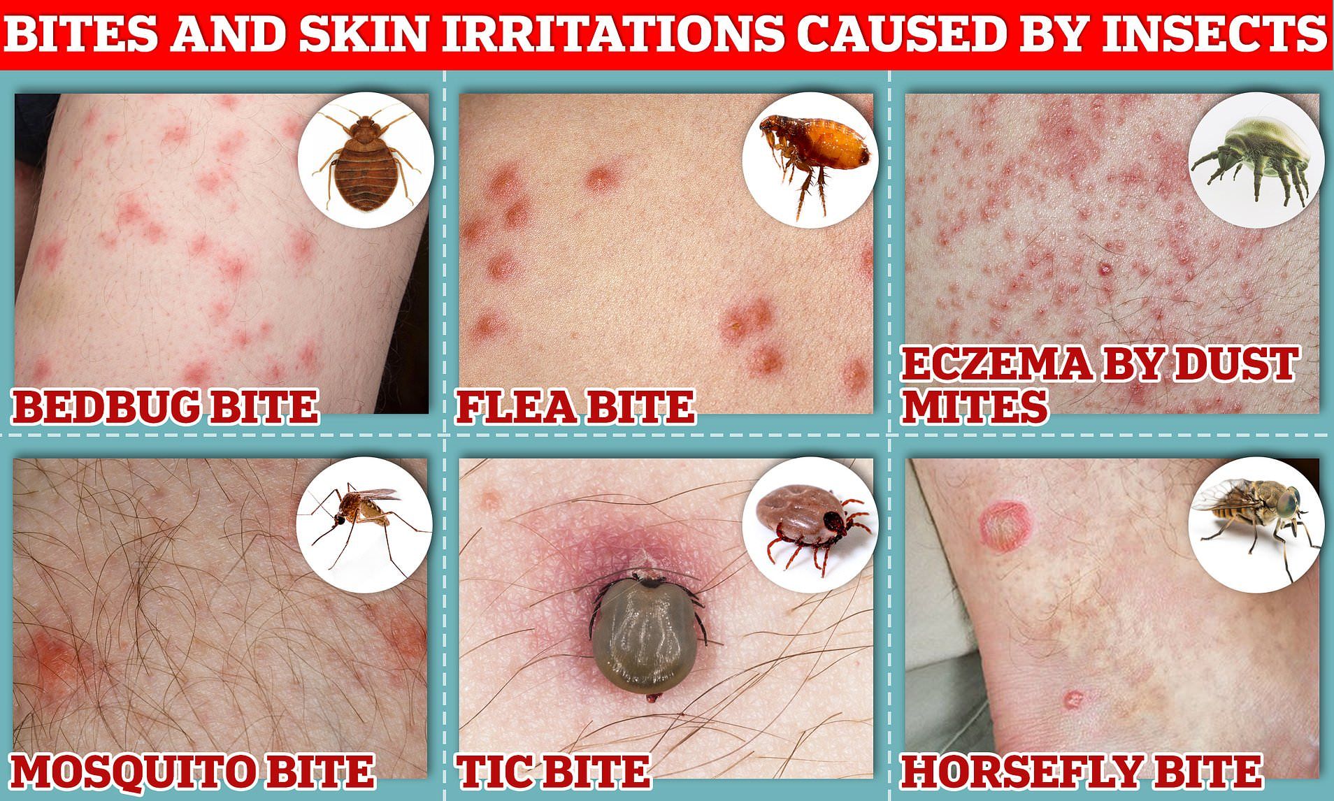 Bed Bug Bites Symptoms Time Bed Bug Bites Symptoms Time